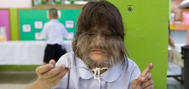 Ella es Supatra, la mujer más peluda del mundo que se afeitó para ...