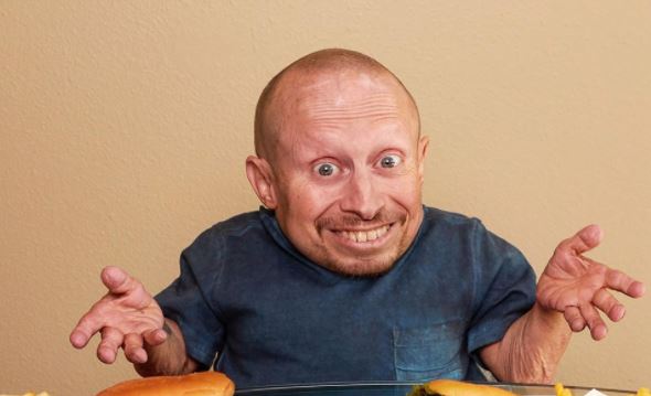 A los 49 años muere Verne Troyer, “Mimi me” en Austin Powers ...